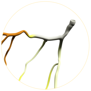 Patient Education - CathWorks