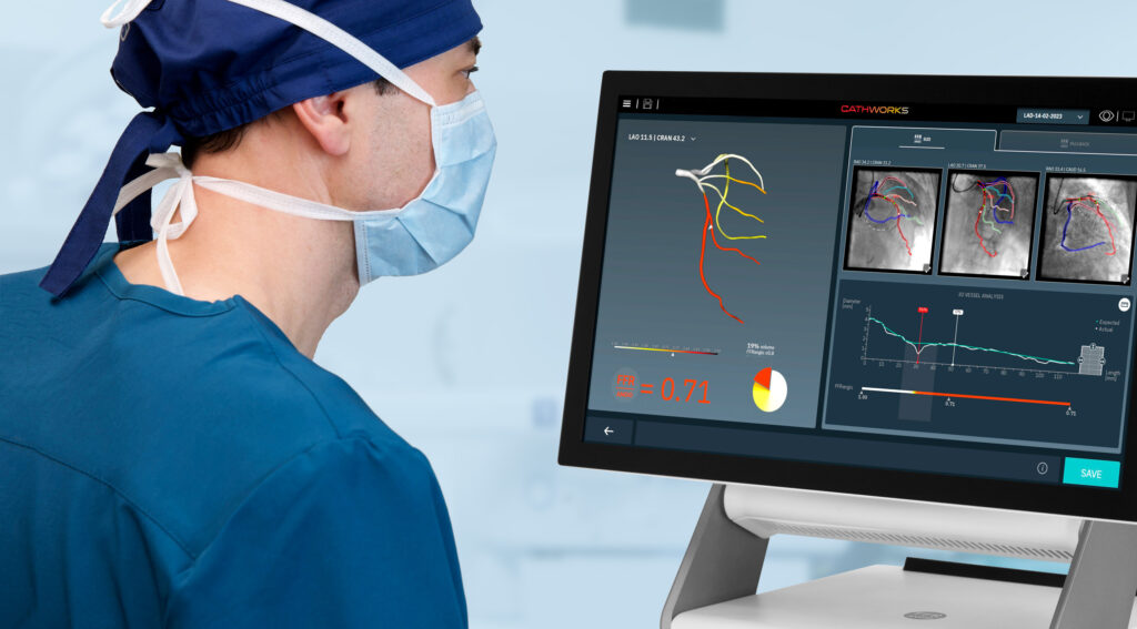 Cathworks FFRangio - CathWorks FFRangio System