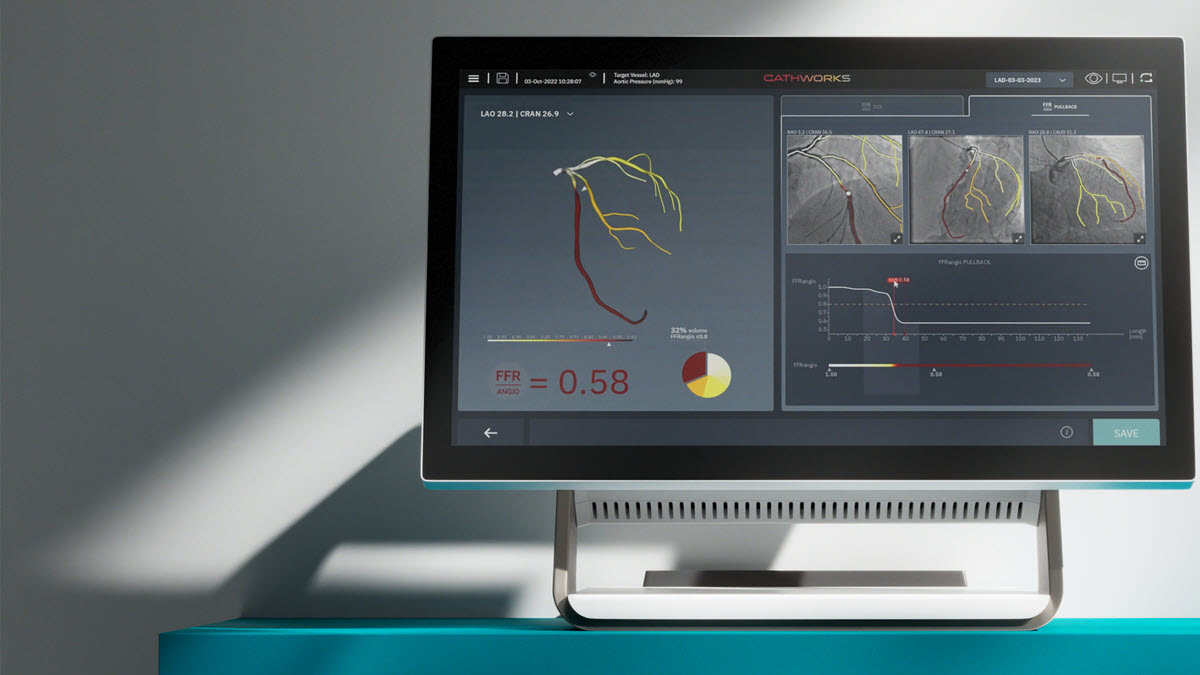 Home Page - CathWorks