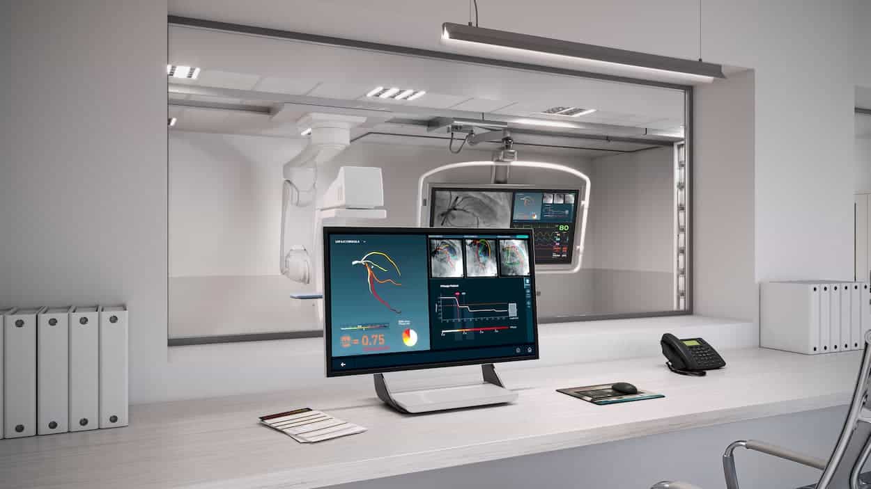 Cathworks FFRangio - CathWorks